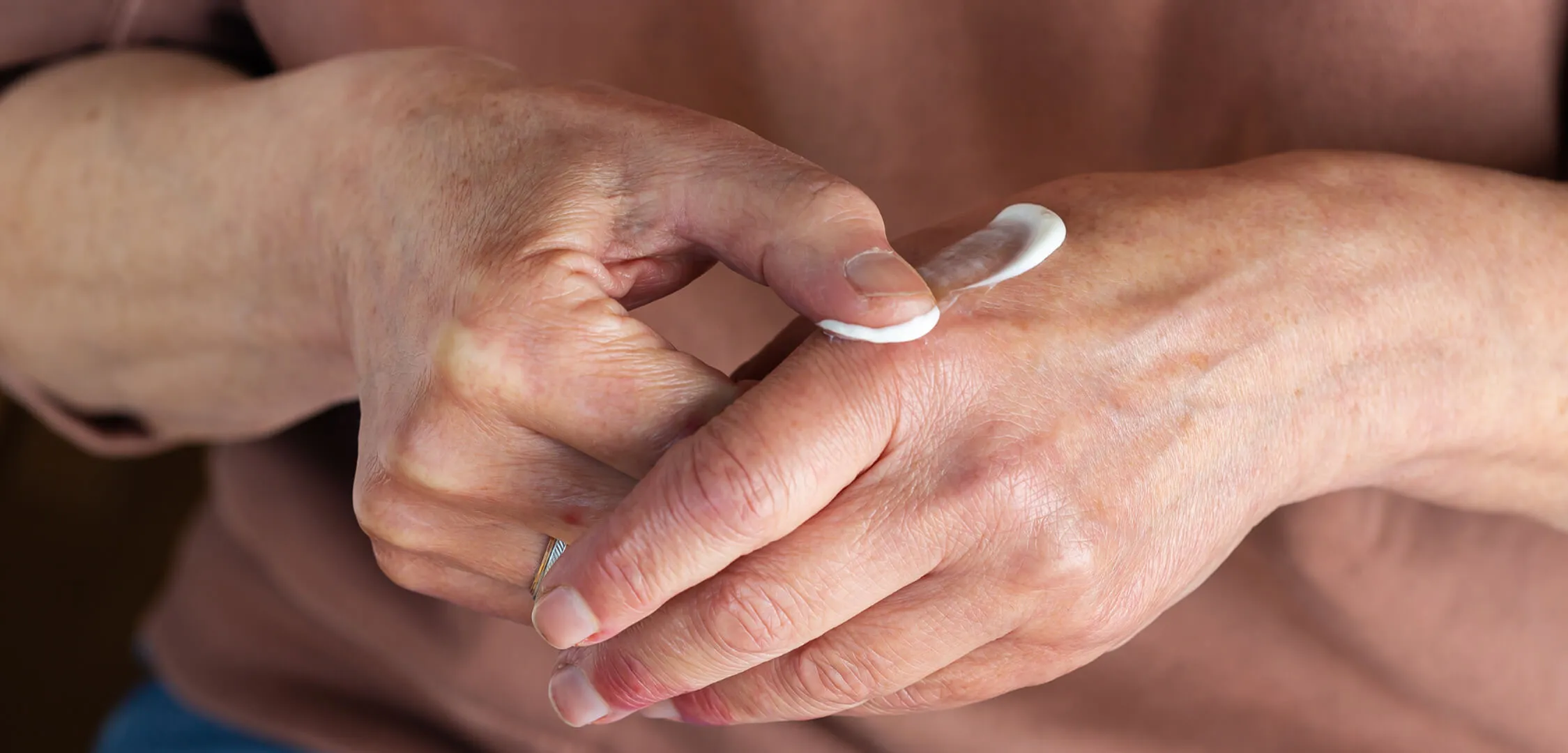 Frontier Dermatology | The Pacific Northwest’s Authority on Medical and ...